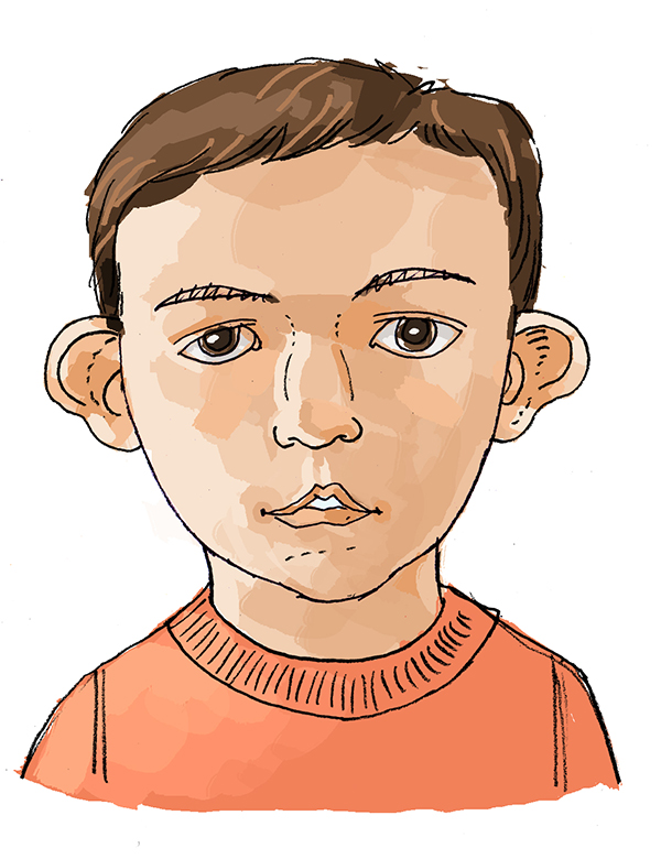 22q11 deletion syndrome - Public_munhcenter