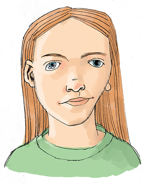 Goldenhar syndrome - Public_munhcenter