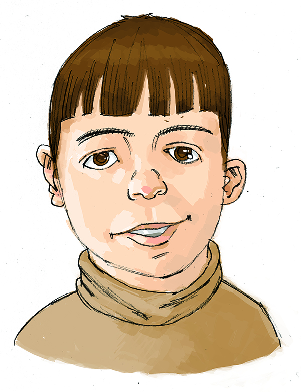 Goldenhar syndrome - Public_munhcenter