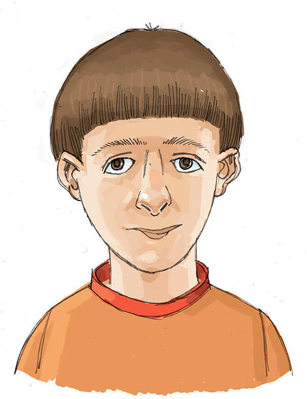 RubinsteinTaybi syndrome - Public_munhcenter