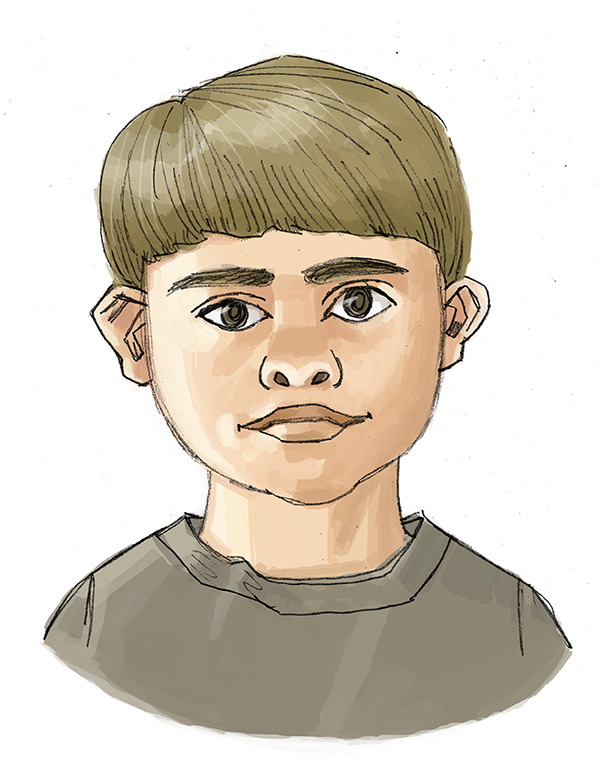 Smith-Magenis syndrome - Public_munhcenter